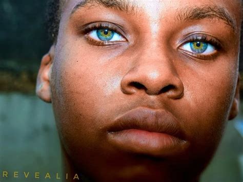 Gorgeous Heterochromia Eyes Beautiful Eyes Color Most Beautiful Eyes