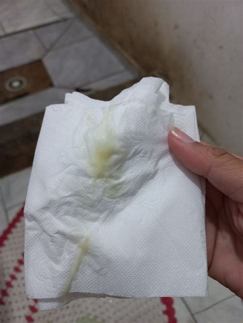 Corrimento Amarelo Na Gravidez BabyCenter