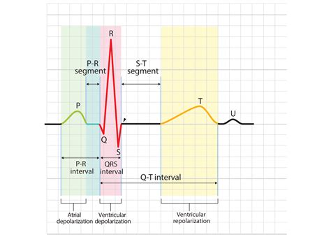 Topic Waves Complexes Segments And Intervals Arrhythmia Interpretation Certification