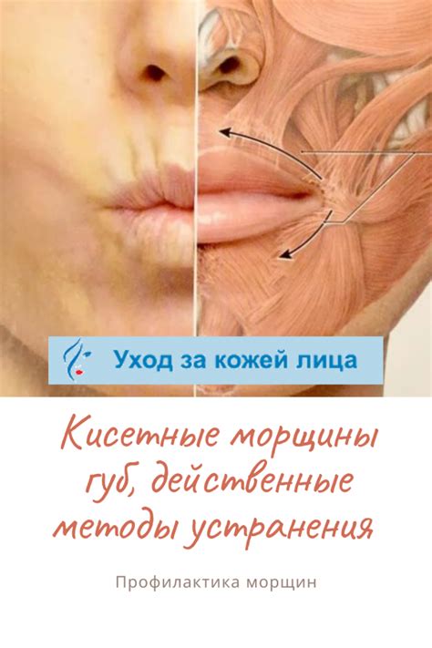 Кисетные морщины губ, действенные методы устранения в 2020 г | Здоровье ...