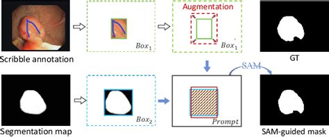 Segment Anything Model Guided Collaborative Learning Network For Scribble Supervised Polyp