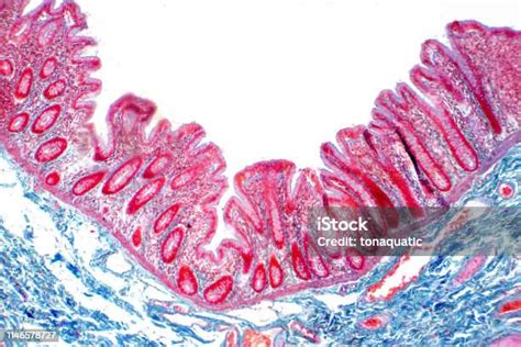 Menschlichen Dickdarm Gewebe Unter Mikroskop Ansicht Histologischen Für Humanphysiologie