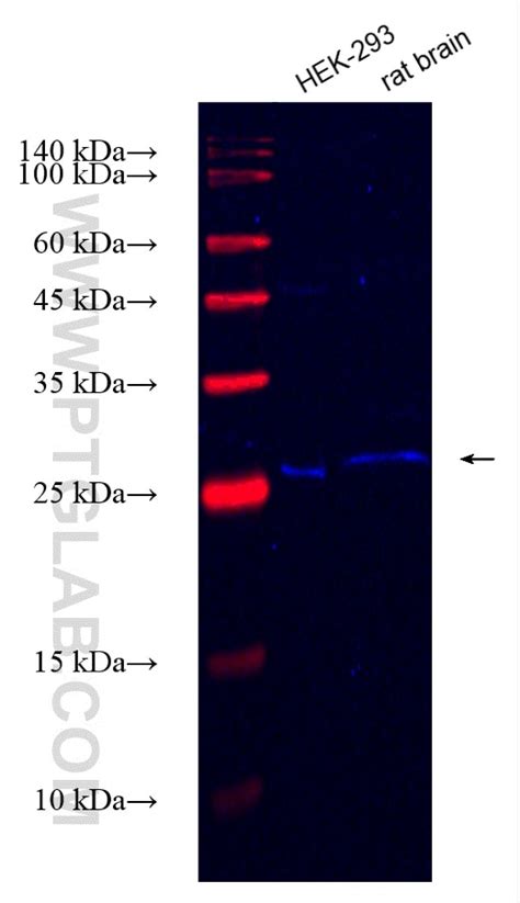Scn3b Antibody Cl750 82959 7 Proteintech