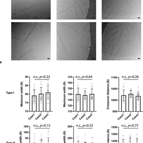 Immunolabelling Of Tau Filaments Extracted From The Frontal Cortex Of