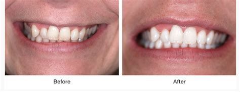 Rehabilitation Services In Hyderabad By Opal Dental Care Id 18961927891