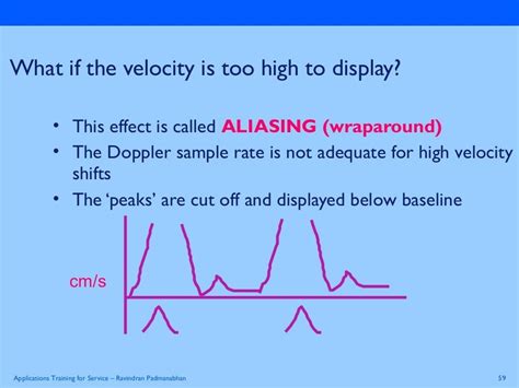 Basics Physics Of Ultrasound Ultrasound School Ultrasound Ph