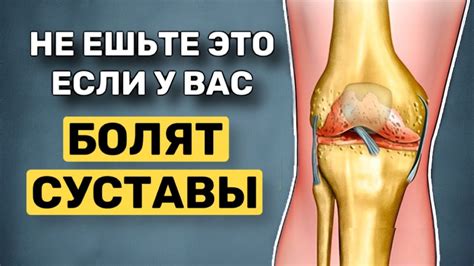 Никогда не ешьте эти продукты, если у Вас БОЛЯТ СУСТАВЫ. - YouTube