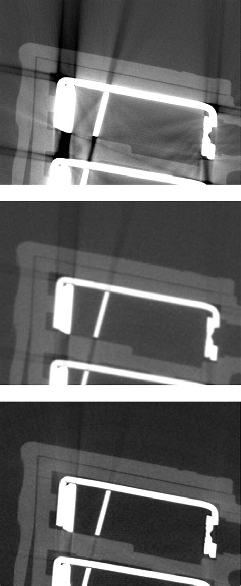 New Multispectral Computed Tomography