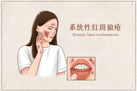 【市中医膏方节】中医有“膏”招（7）：“蝶友”冬令如何补？辨证识体服膏方澎湃号·政务澎湃新闻 The Paper