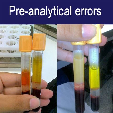 External Quality Assessment For The Pre Analytical Phase With The