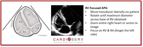 Introduction To Right Heart Assessment Cardioserv