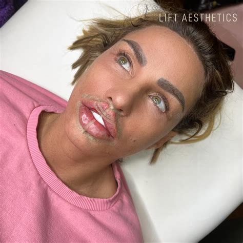 What Are Butterfly Lips Wear Next