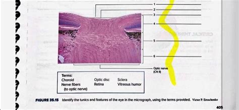 Solved Figure 3515 Identify The Tunics And Features Of The