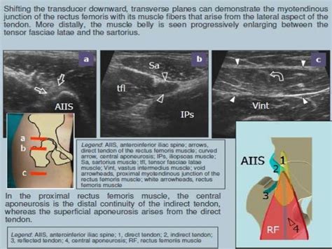 Hip Adductors Ultrasound