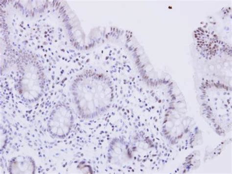 wrn polyclonal antibody pa5 27319