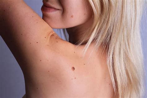 Dermatology Nurses Association On Linkedin Dna Nurses Nursing