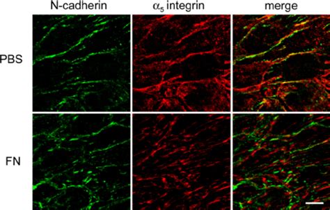 Fibronectin Disrupts ␣ 5 ␤ 1 Integrin N Cadherin Co Localiza Tion