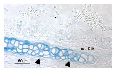 Alcian Blue Ab Staining On The Bronchial Epithelial Mucus In Bn Rat