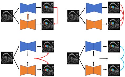 논문 리뷰 Learnable Prompting SAM induced Knowledge Distillation for Semi supervised Medical Image