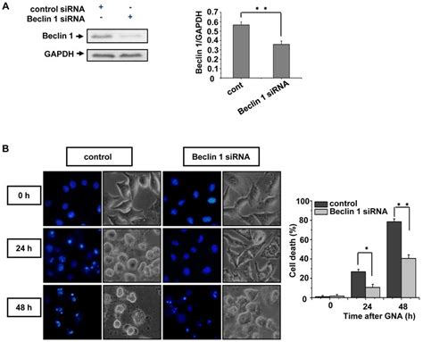 The Knockdown Of Beclin 1 Decreases Gna Induced Cancer Cell Death A