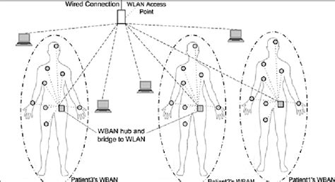 Figure 1 From Fuzzy Inference System Wireless Body Area Network Architecture Simulation For