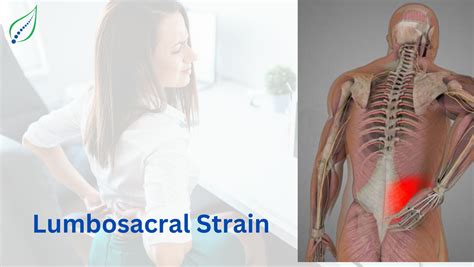 Lumbar Strain