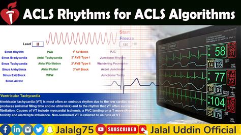Acls Rhythms For Acls Algorithms Youtube
