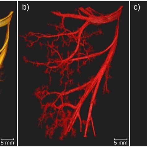 3d visualization of segmented ct data to visualize solely the