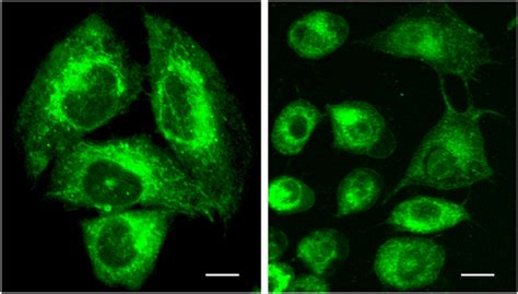 Two Photon Fluorescence Microscopy Image λ Exc 750 Nm Of Ros Rat