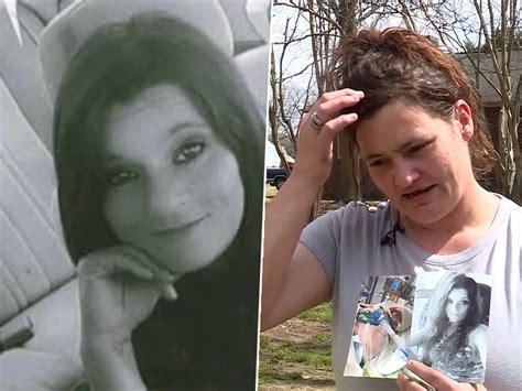 Kyleen 38 Overleeft Aanval Drie Honden Maar Verliest Beide Armen En Been Foto Hlnbe