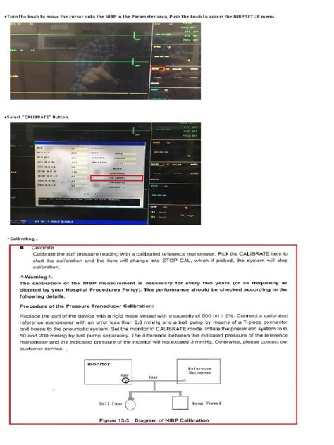 Nibp Calibration Pdf