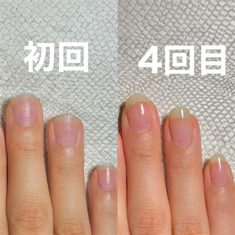佐藤美貴奈良市富雄深爪自爪育成サロンパラジェルフィルイン土日営業 ピンクの部分が小さくて指先に向かって広がっていた。少し子供