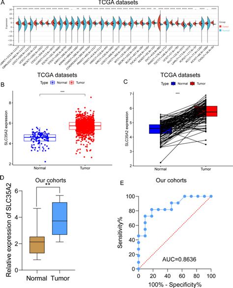 Slc35a2 Is A Novel Prognostic Biomarker And Promotes Cell Proliferation