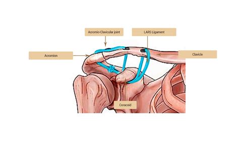 London Upper Limb Surgery