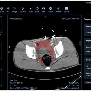 Client Side Display Of DICOM Images Segmentation Mask And A