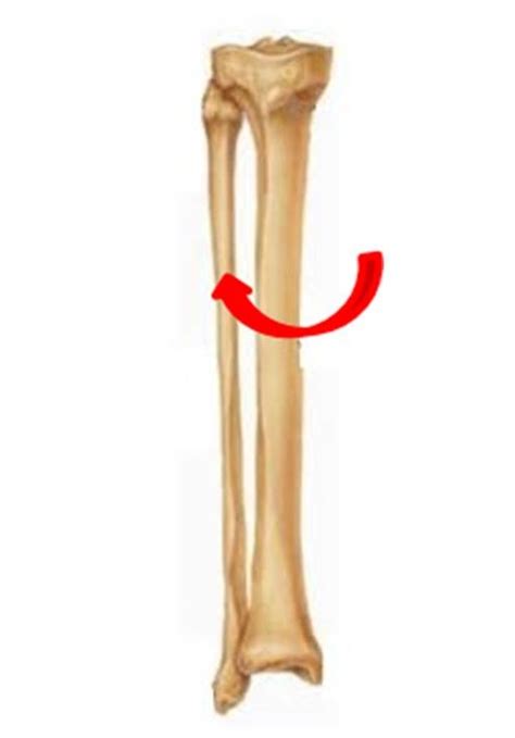 Torsion Tibioperoneal Efisiopediatric