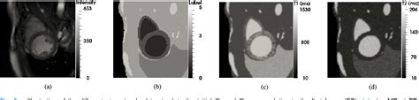 Figure 2 From A Framework For The Generation Of Realistic Synthetic Cardiac Ultrasound And