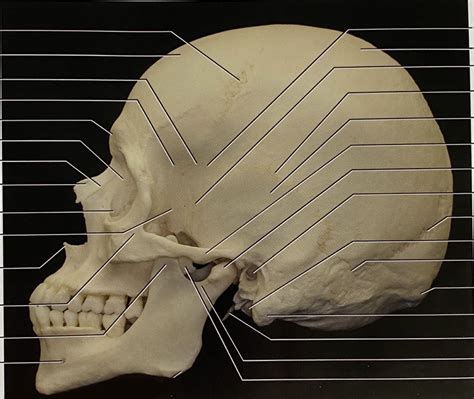Rohen Images Osteology Block 2 Image 2 Skull Left Lateral View