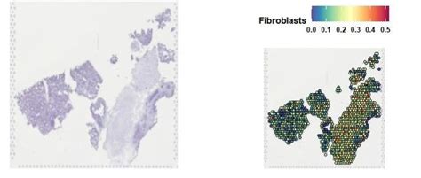 空间转录组 没有单细胞数据如何做空转spot “注释”？文献和代码都给你！ 知乎