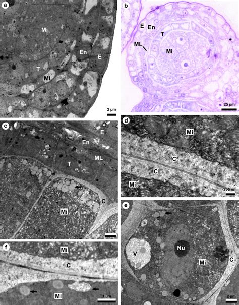 Young Anthers With Developing Microsporocytes In Juncus Imbricatus A