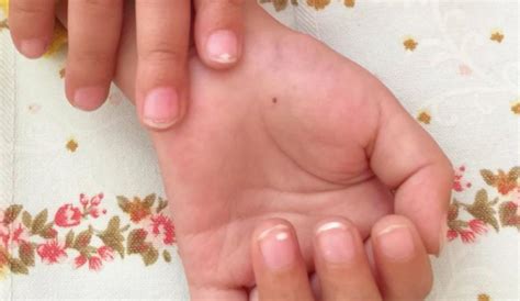 宝宝指甲上有白点是因为缺钙或是肚子有虫真相是这样 澎湃号湃客 澎湃新闻 The Paper