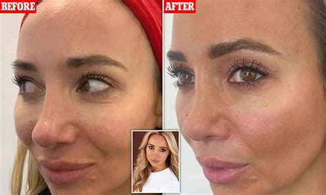 Which Ot Wives Are Asking For A Salmon Sperm Facials And Injections