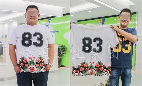 细数一下减重手术能给你带来哪些好处！ 知乎