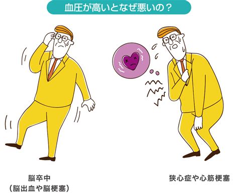 「高血圧」コロナ禍でリスク高まる：働く人とそのご家族のための健康講座｜日本経済新聞 電子版特集