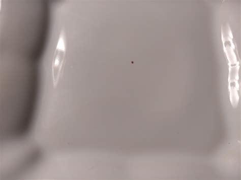 Bed Bug Or Chigger Album On Imgur