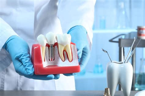 Which Is The Leading Cause Of Dental Implant Failure