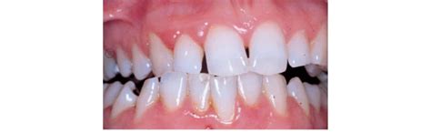 𝐎𝐜𝐜𝐥𝐮𝐬𝐚𝐥 𝐭𝐫𝐚𝐮𝐦𝐚 🦷 𝐅𝐨𝐫𝐞𝐬𝐭 And 𝐑𝐚𝐲 😊 𝐃𝐞𝐧𝐭𝐢𝐬𝐭𝐬 𝐎𝐫𝐭𝐡𝐨𝐝𝐨𝐧𝐭𝐢𝐬𝐭𝐬 𝐈𝐦𝐩𝐥𝐚𝐧𝐭 𝐒𝐮𝐫𝐠𝐞𝐨𝐧𝐬