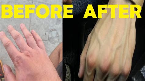 How To Get Veiny Hands Easy Exercises Youtube