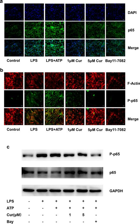 Curcumin Inhibited Nf κb P65 Phosphorylation In Hdpscs Stimulated With