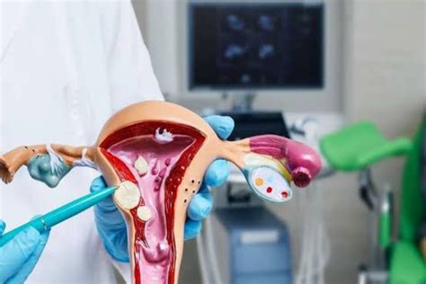 Cirurgia Robótica No Tratamento De Miomas Uterinos Preserva A
